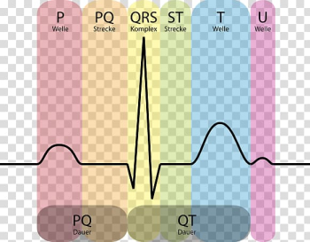 Free: Electrocardiography Cardiology Heart Sinus rhythm, ecg ...