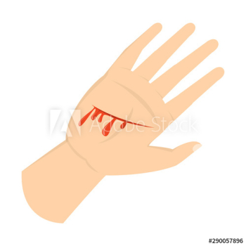 Diabetic foot ulcer chronic wound and skin complication - top related ...