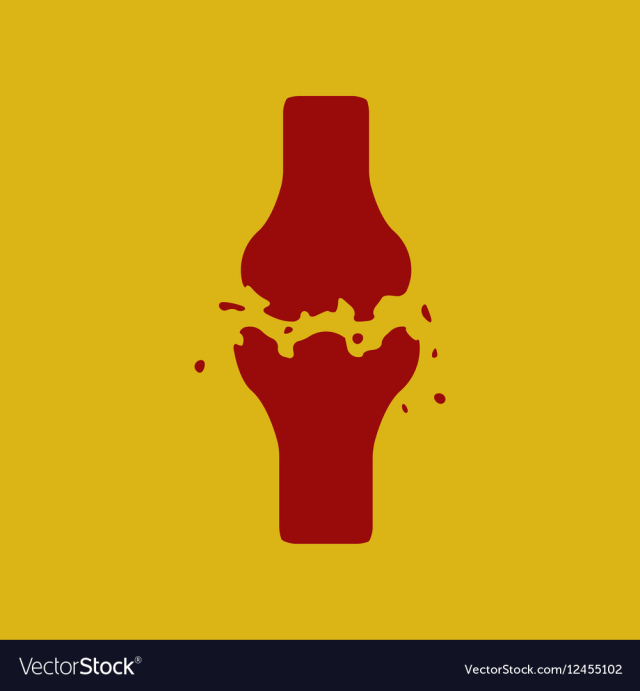 Free: Bone fracture vector image - nohat.cc