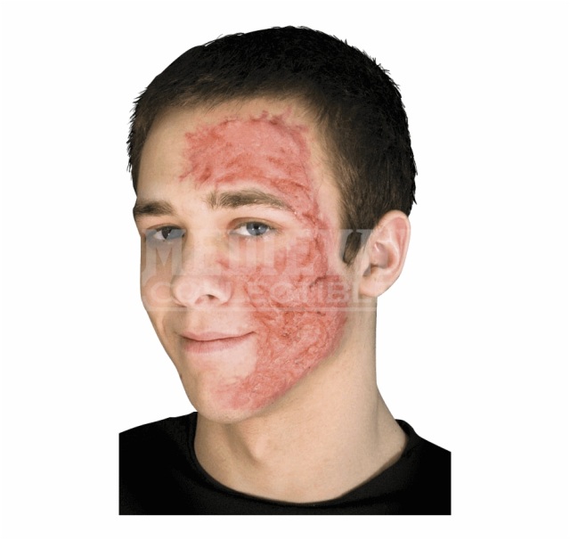 Free: Burn Scar Face Free PNG Images & Clipart Download #414132 ...