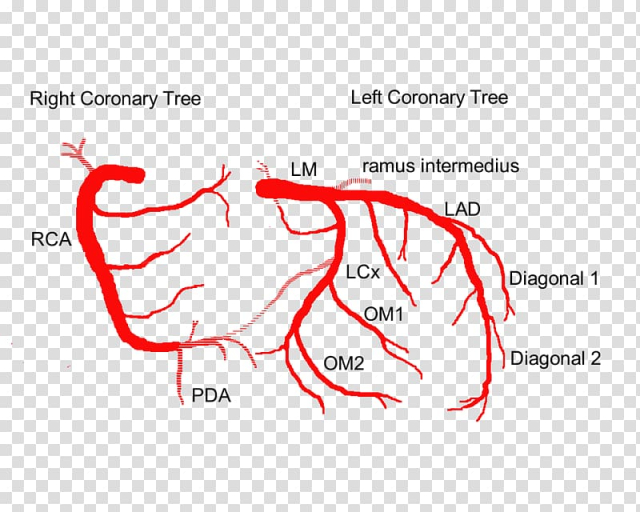 Free: Coronary arteries Left coronary artery Heart Anatomy, heart ...