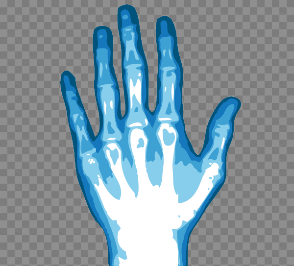 Free: X-Ray PNG Image Background - nohat.cc