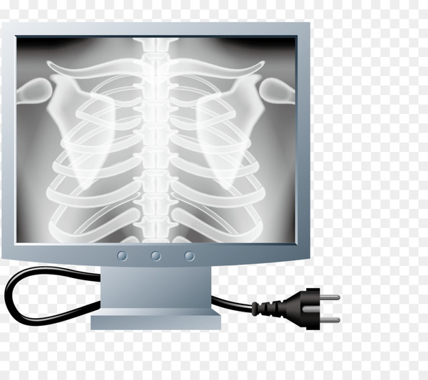 Free: X-ray Rib Bone Cartoon - Check bones - nohat.cc